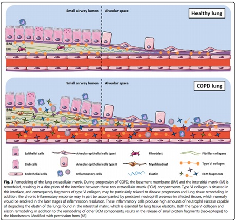 Method for isolating circulating epithelial pulmonary cells and their ...